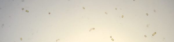 Thalassiosira: Big & Beneficial | Phytoplankton Education | AlgaeBarn