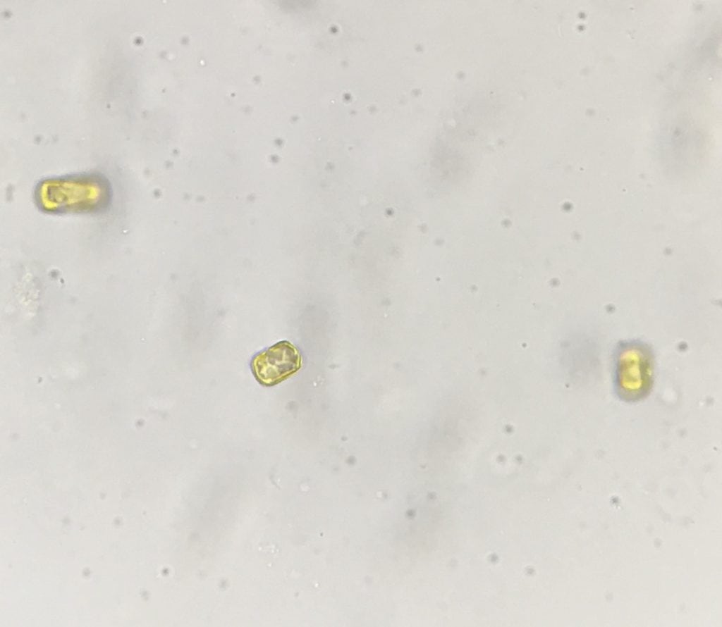 Thalassiosira: Big & Beneficial | Phytoplankton Education | AlgaeBarn