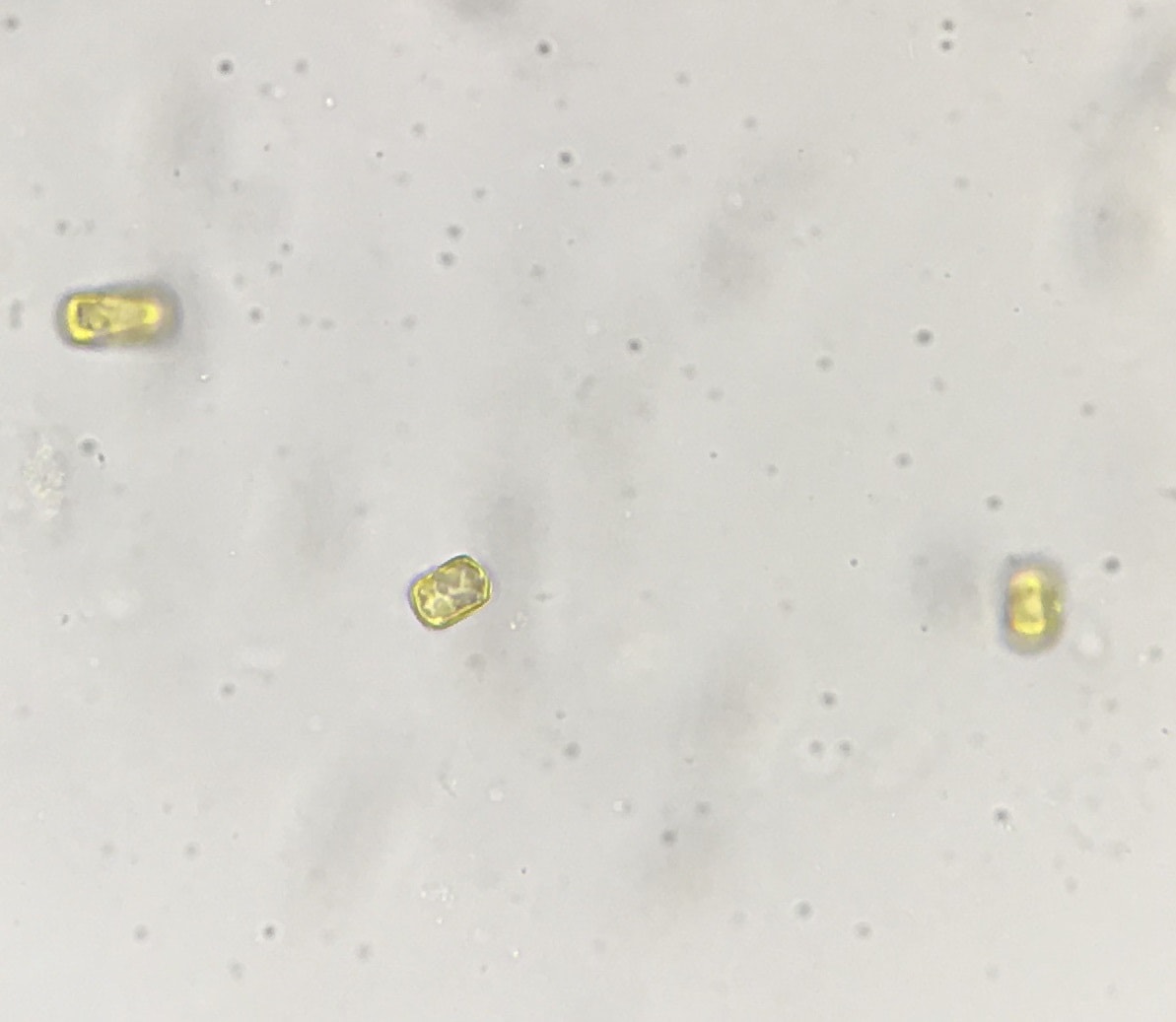 Thalassiosira: Big & Beneficial | Phytoplankton Education | AlgaeBarn