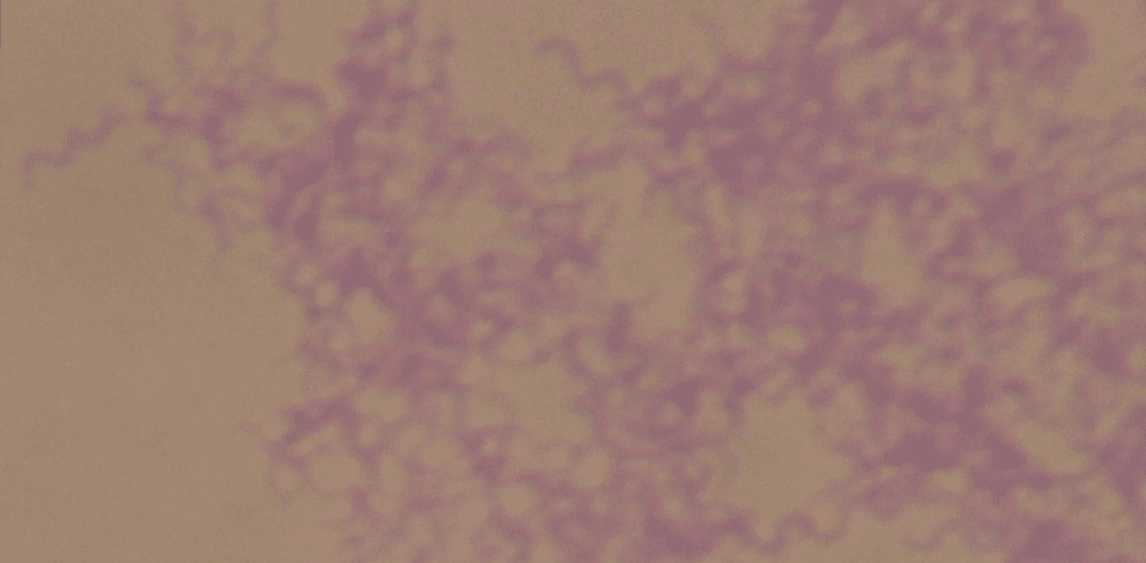 Purple Non-Sulfur Bacteria? | The Planted Tank Forum